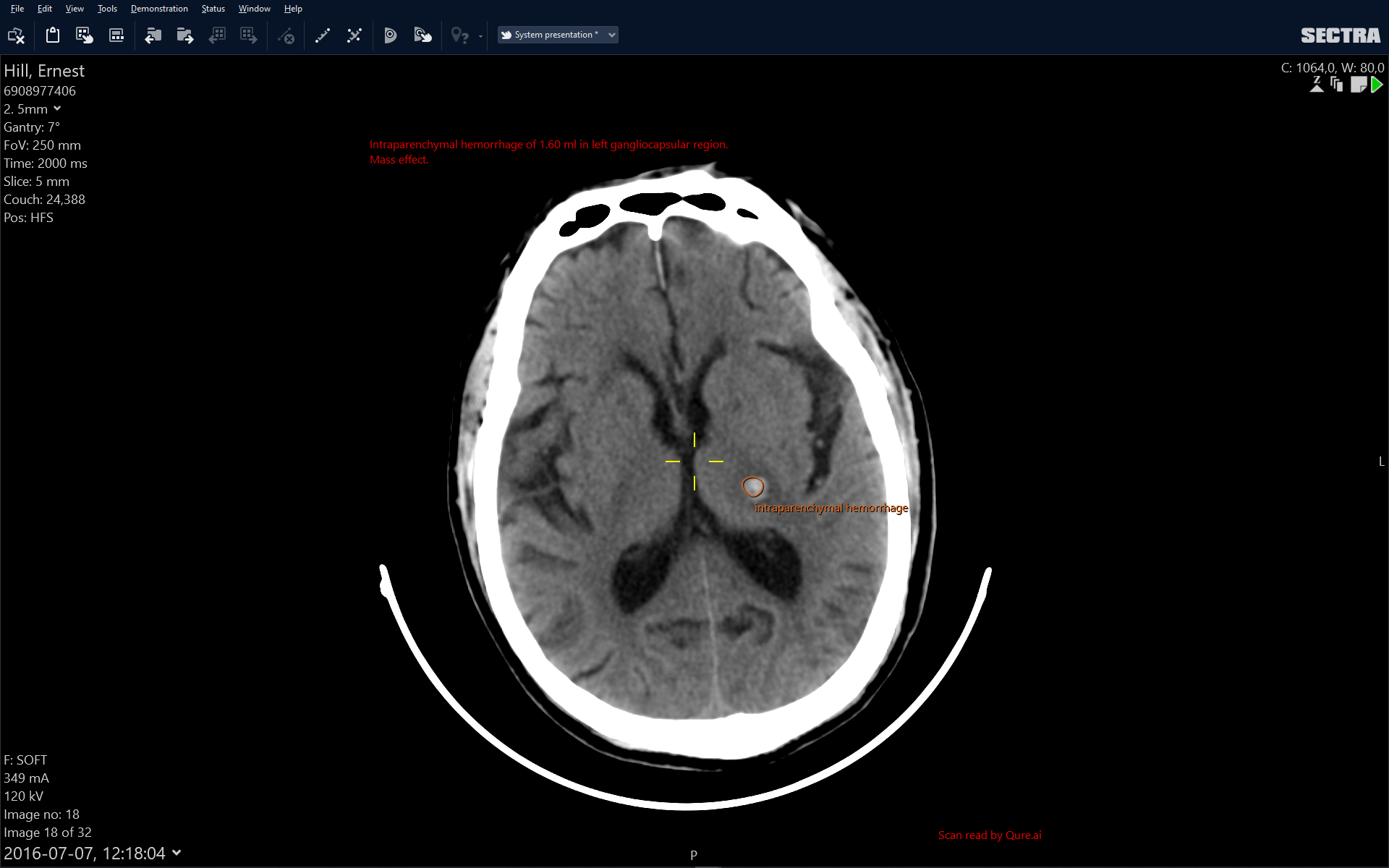 qER | Sectra Global E-learning